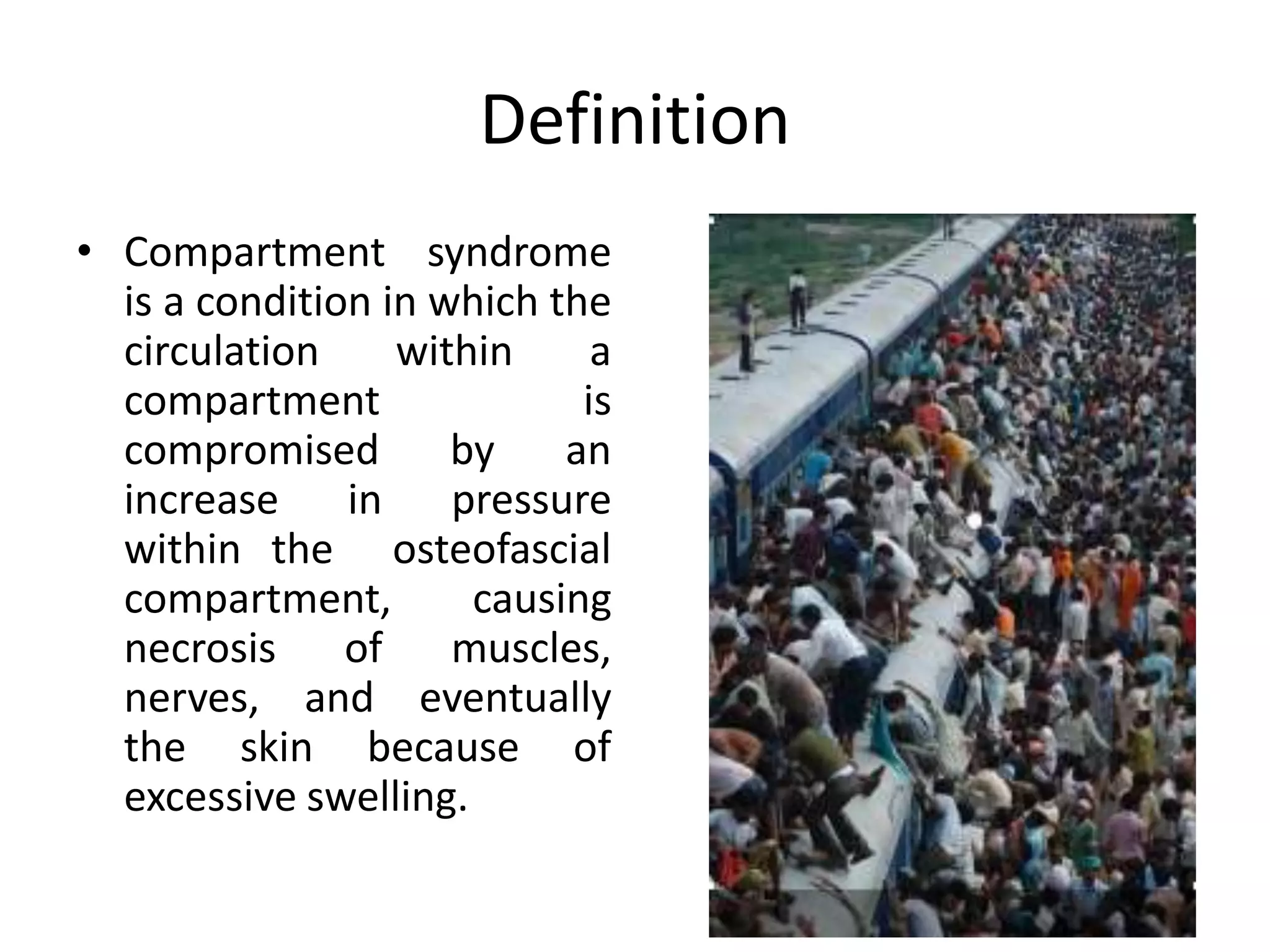 Compartment syndrome | PPTX