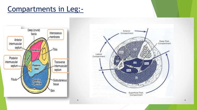 Compartment syndrome | PPTX
