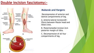 Compartment syndrome | PPTX