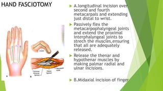 Compartment syndrome | PPTX