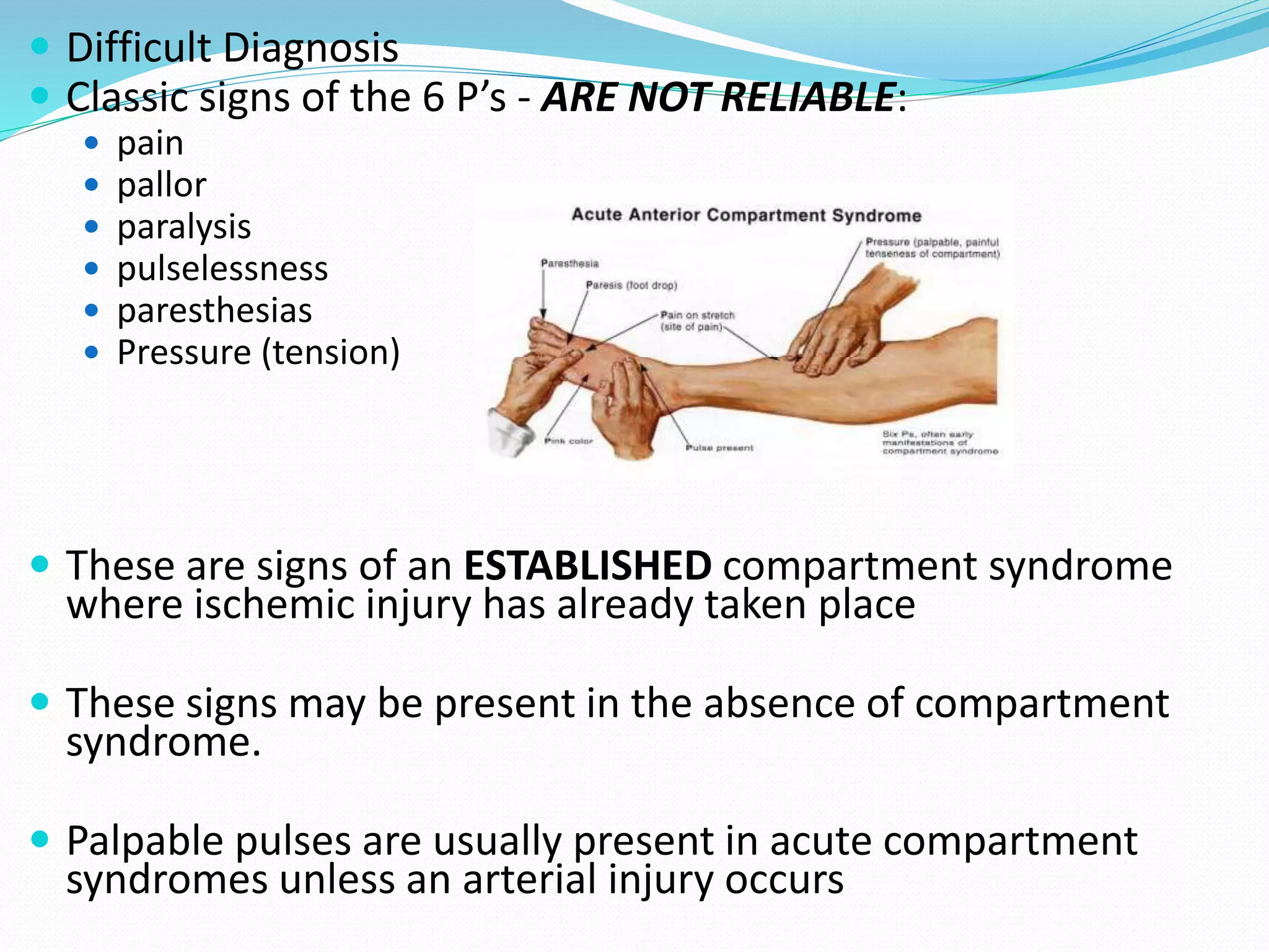 Compartment syndrome | PPTX