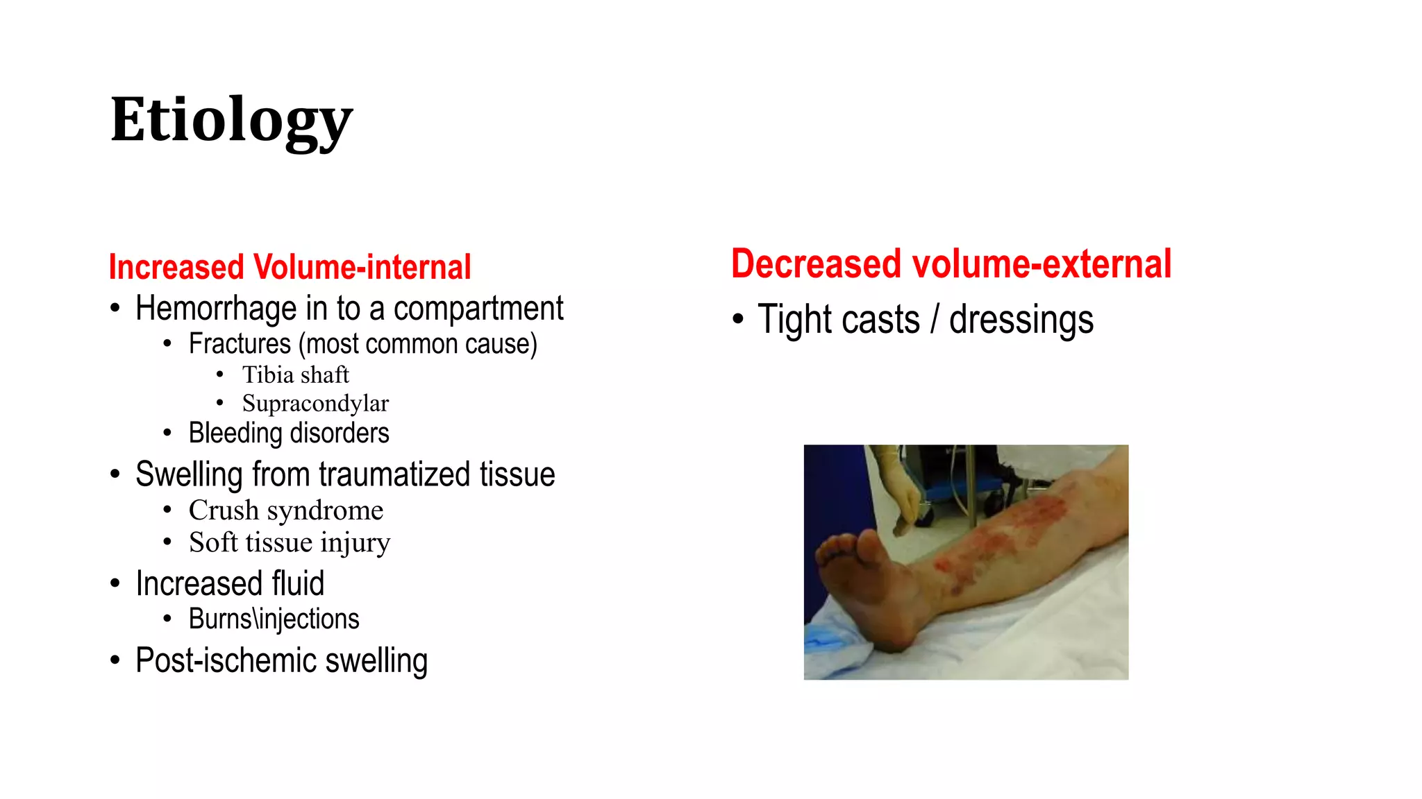 Compartment syndrome.ppt
