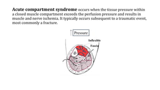 Compartment syndrome.ppt