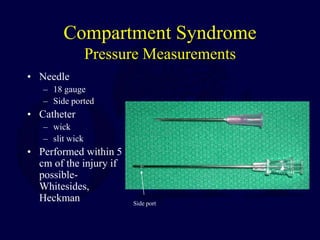 Compartment Syndrome.ppt
