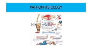 COMPARTMENT SYNDROME.pptx