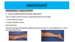 COMPARTMENT SYNDROME.pptx