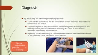 compartment syndrome.pptx | Death, Injury, or Military Conflict ...