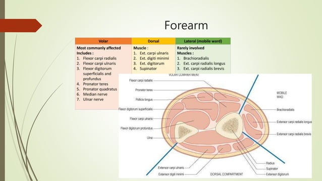 compartment syndrome.pptx