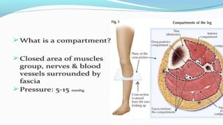 Compartment Syndrome Orthopaedic Mbbs.pptx