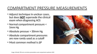 Compartment Syndrome diagnosis & management.pptx