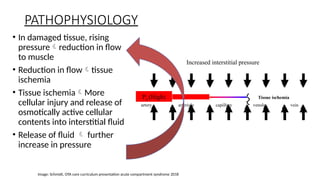 Compartment Syndrome diagnosis & management.pptx