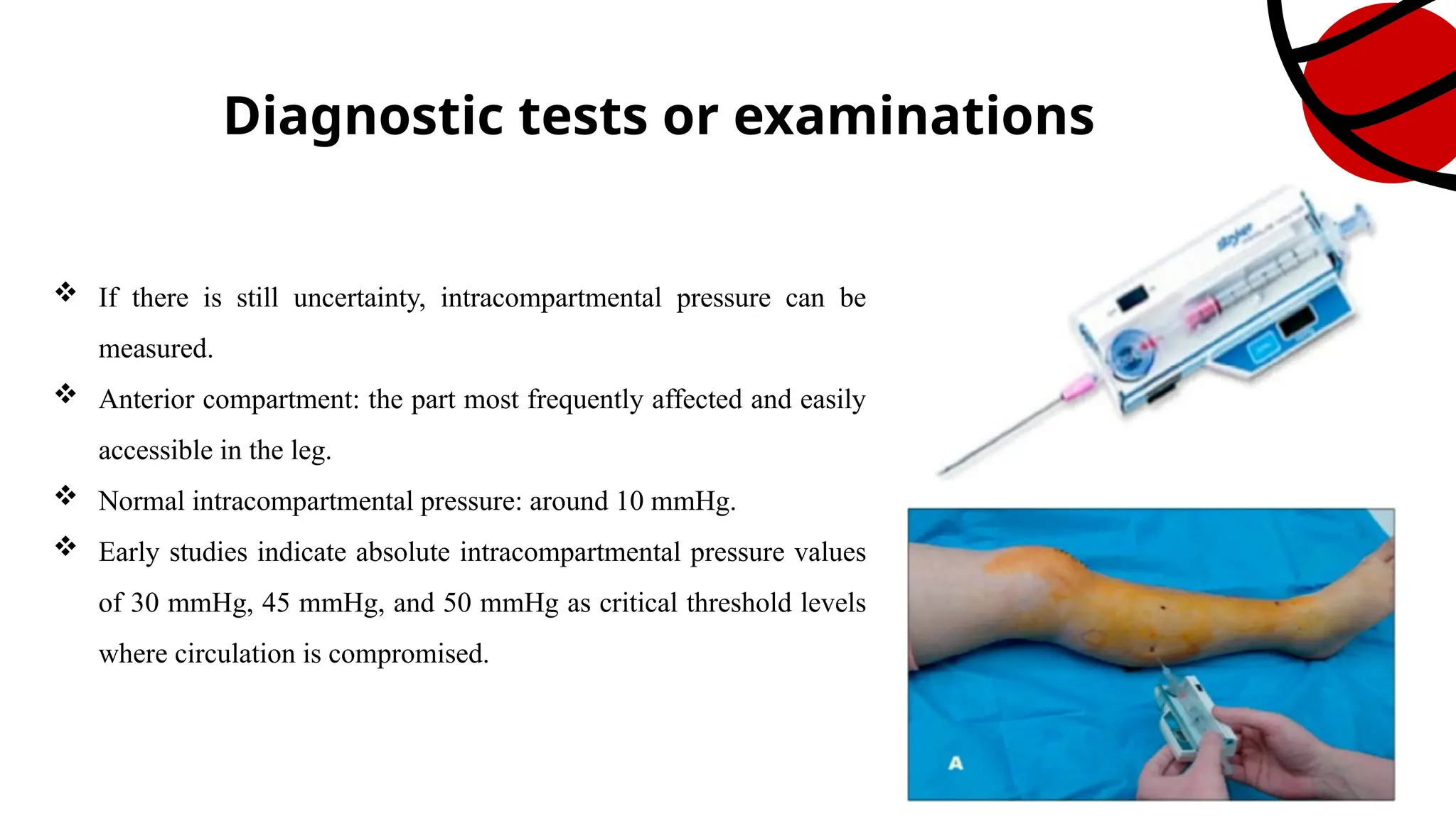COMPARTMENT SYNDROME.............................. | PPTX