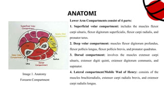 COMPARTMENT SYNDROME.............................. | PPTX