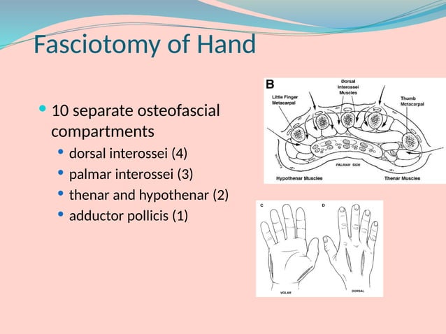 COMPARTMENT SYNDROME , CLINICAL FEATURES & MANAGEMENT.ppt