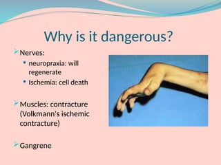 COMPARTMENT SYNDROME , CLINICAL FEATURES & MANAGEMENT.ppt