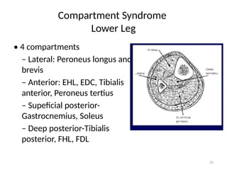 Compartment Syndrome.pptx PowerPoint presentation | PPTX