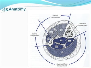 Compartmentsyndrome | PPT
