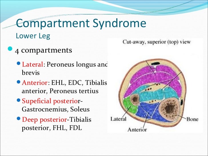 Lower leg compartment syndrome - leryfast
