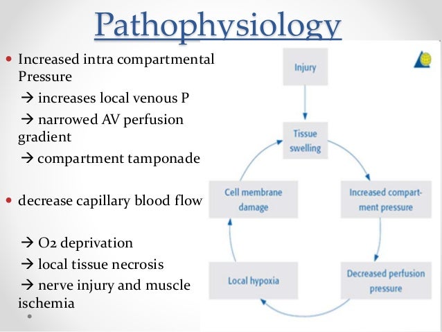 Compartment Syndrome