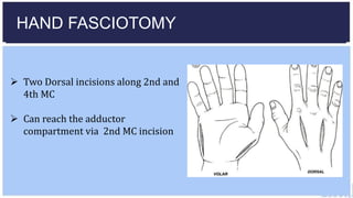 Compartment syndrome and VIC | PPTX