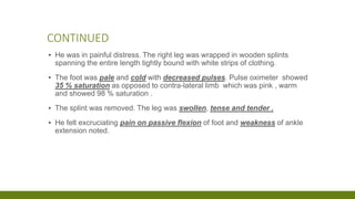 Compartment syndrome | PPTX