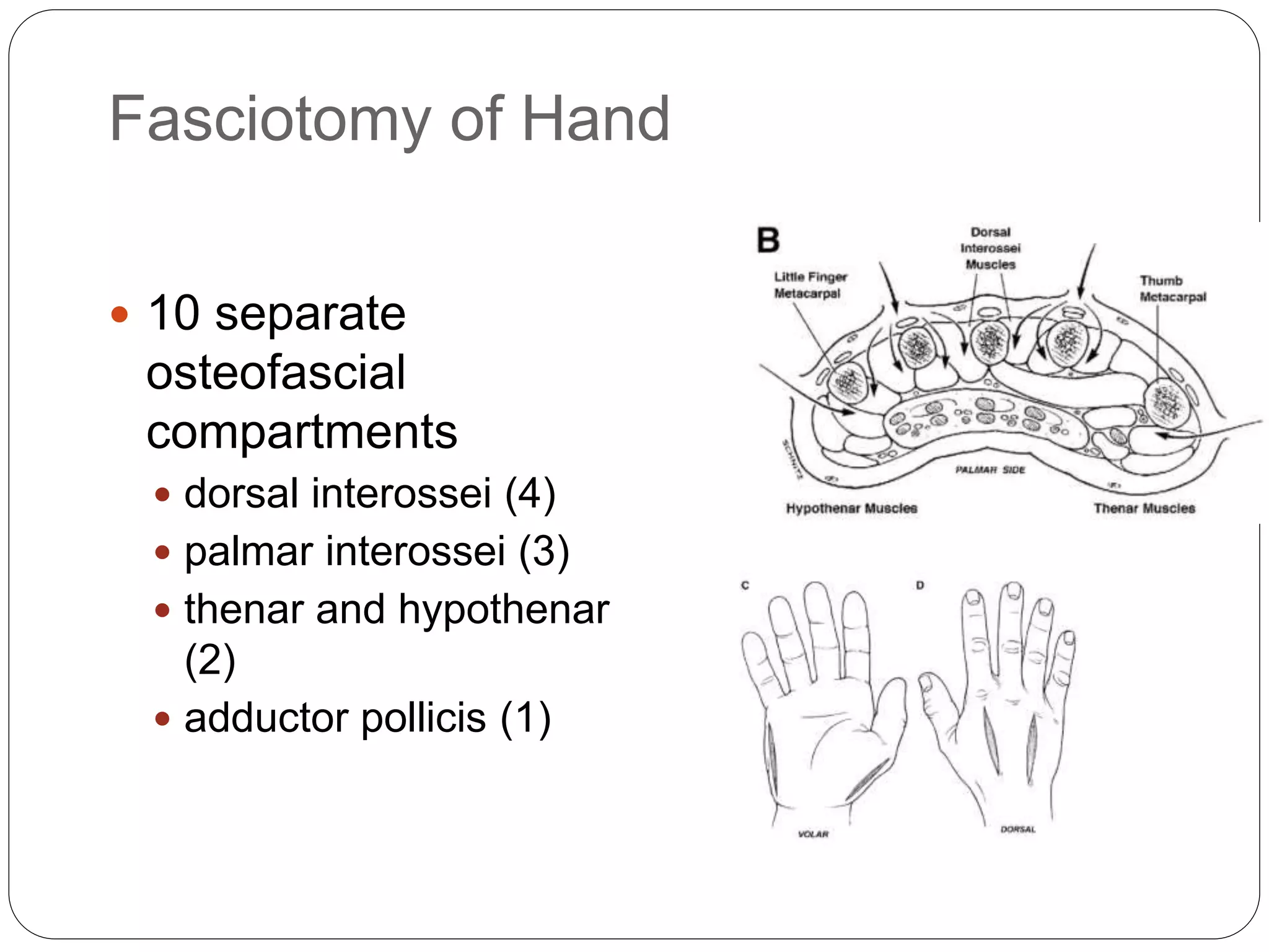 Compartment syndrome in orthopaedics | PPTX