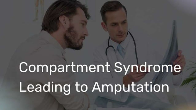 Compartment Syndrome Leading to Amputation | PPTX