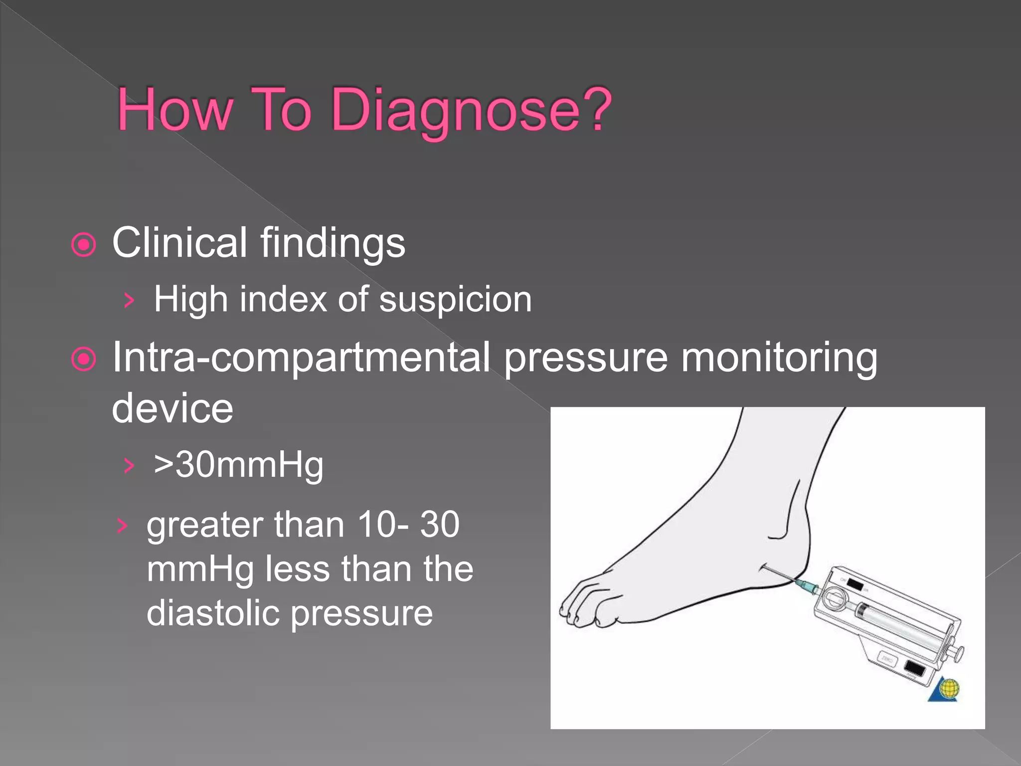 Compartment Syndrome Of The Foot.pptx
