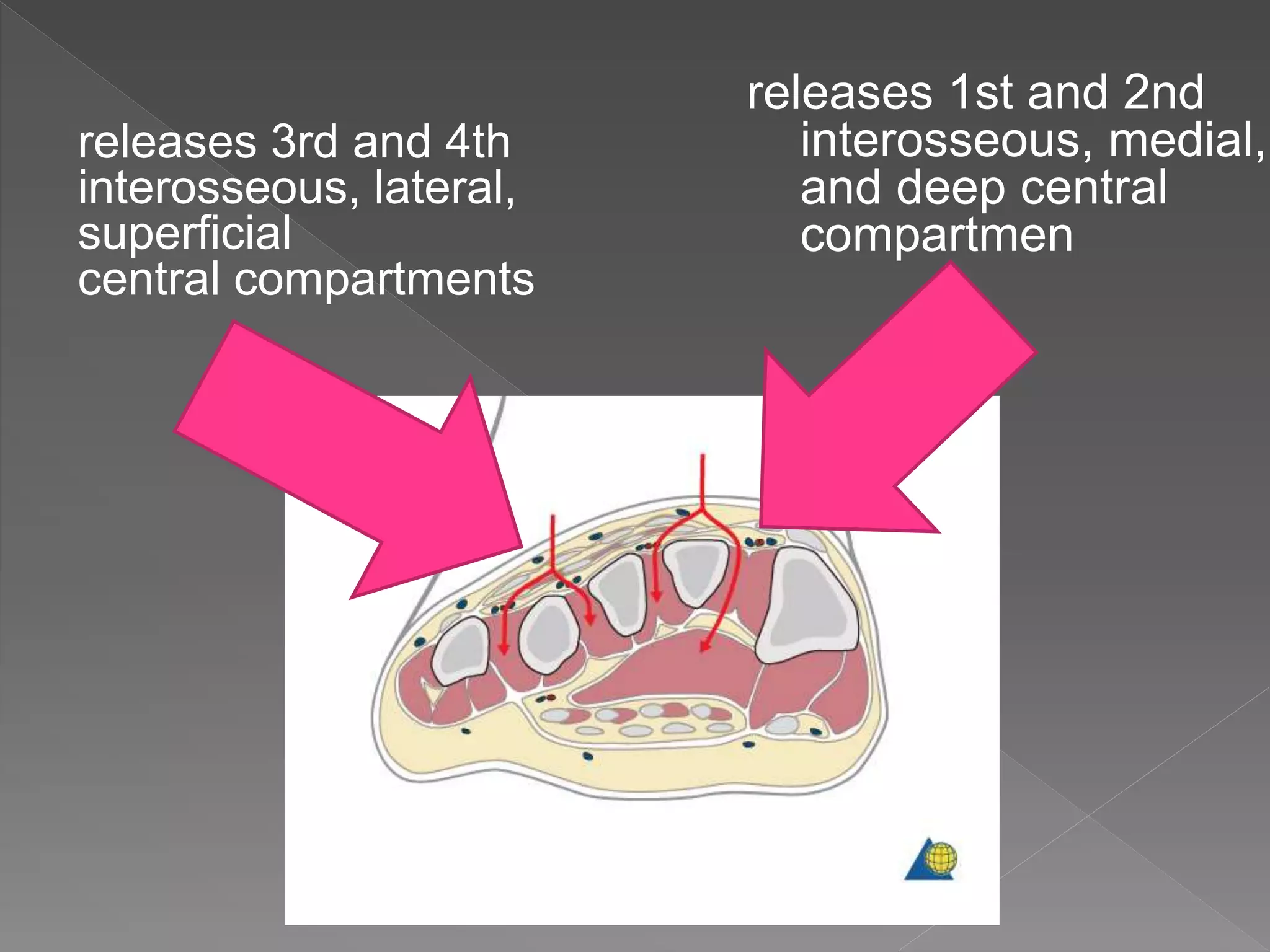 Compartment Syndrome Of The Foot.pptx