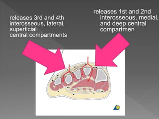 Compartment Syndrome Of The Foot.pptx