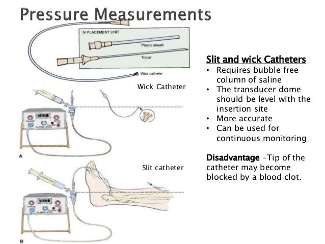 Compartment syndromes