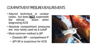 Compartment Syndrome Student Class.pdf