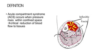 Compartment Syndrome Student Class.pdf
