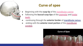 Compensating Curves.pptx
