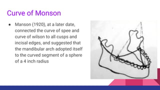 Compensating Curves.pptx