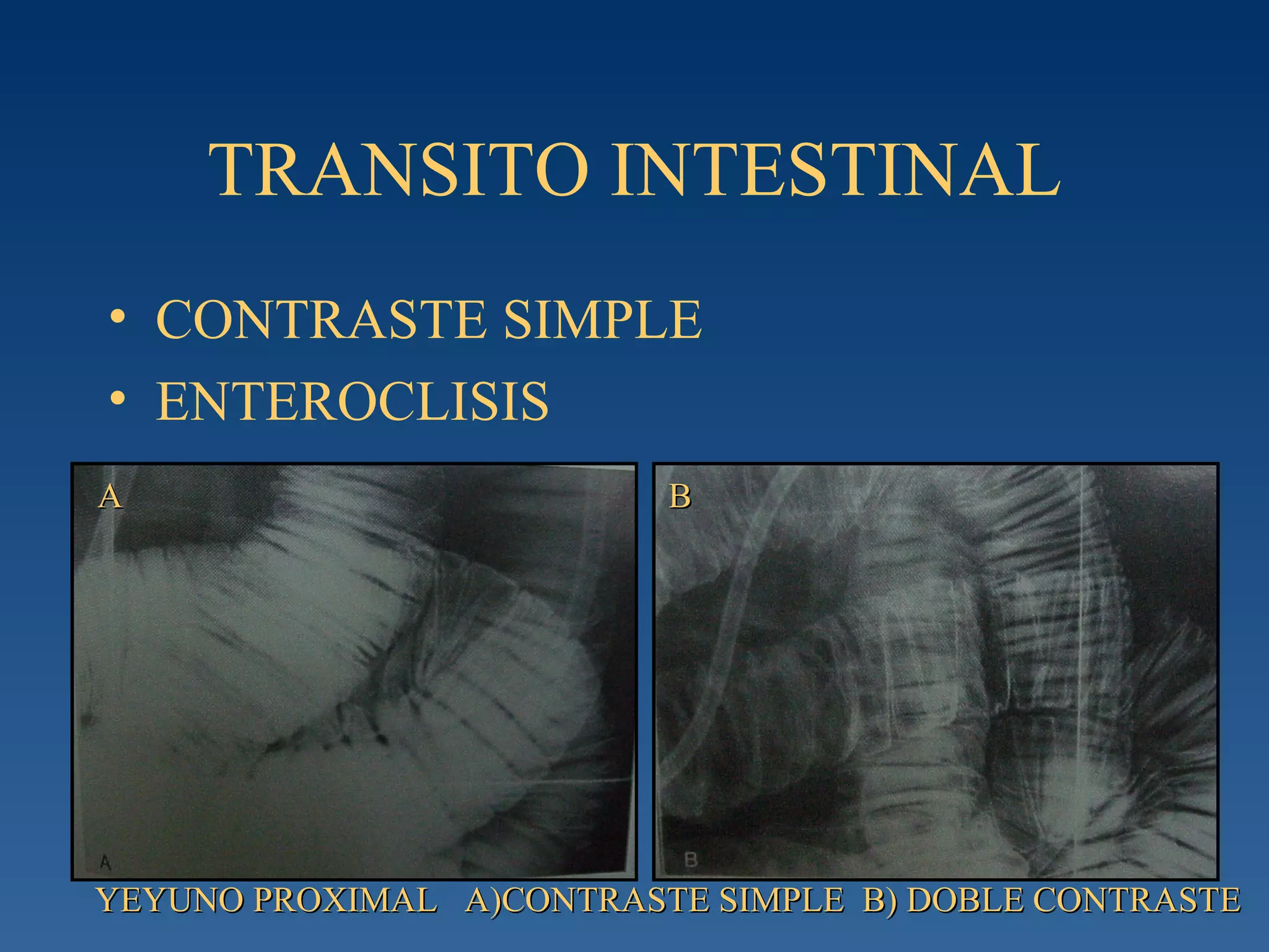Estudios Baritados del Tubo Digestivo | PPT