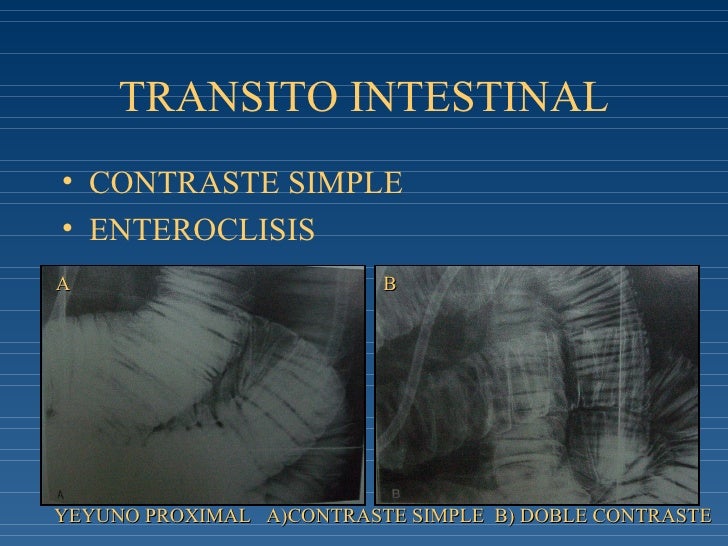 Estudios Baritados del Tubo Digestivo