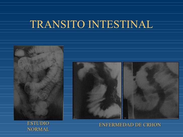 Estudios Baritados del Tubo Digestivo