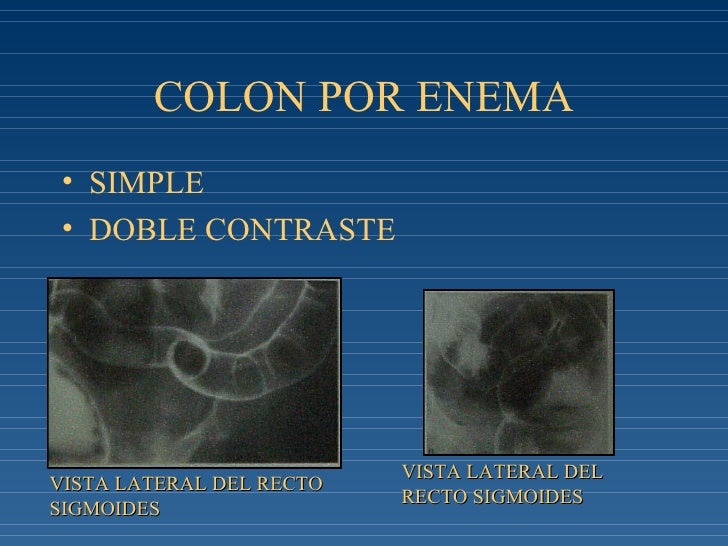 Estudios Baritados del Tubo Digestivo