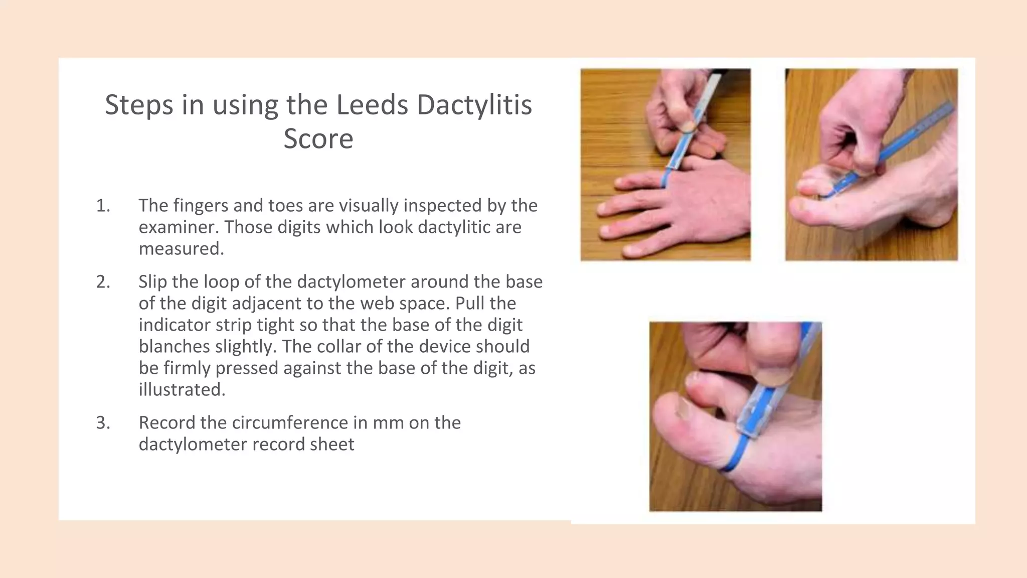 Compiled Scoring Systems in Dermatology_1650928171.pptx | Skin and Dermatology | Diseases and ...