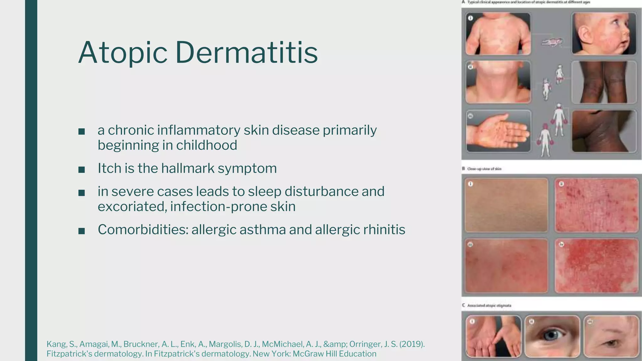 Compiled Scoring Systems in Dermatology_1650928171.pptx | Skin and Dermatology | Diseases and ...