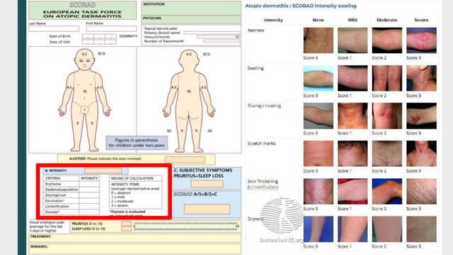 Compiled Scoring Systems in Dermatology_1650928171.pptx | Skin and Dermatology | Diseases and ...