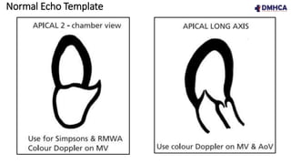 Compiling a report.pptx