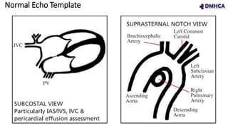 Compiling a report.pptx