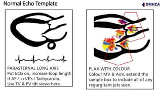 Compiling a report.pptx