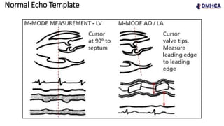 Compiling a report.pptx