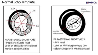 Compiling a report.pptx