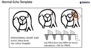 Compiling a report.pptx