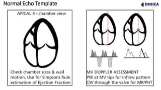 Compiling a report.pptx