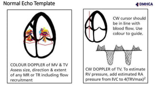 Compiling a report.pptx